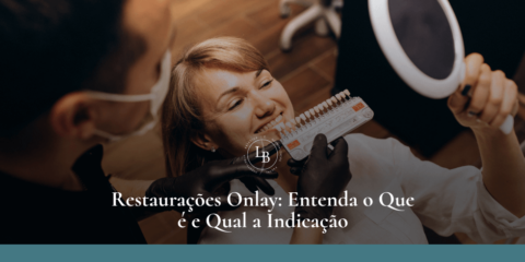 Restauração Onlay Entenda o Que é e Qual a Indicação